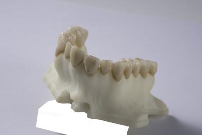 China Presicion Fit Implant Supported Dentures Implant Bar With Locator Attachments for sale