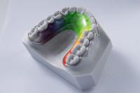 China Dental Laboratory Orthodontic Appliance Custom Fitting For Correct Bite Issues for sale