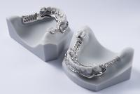 China Customized Removable Dental Prosthetics Accurate Fit ISO FDA CE Approved for sale