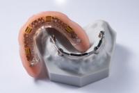 China Perfect Fit Hybrid Combination Dentures Wear Resistance Precision Attachment Denture for sale