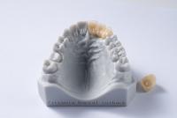 China Custom Made Zirconia Dental Crown Replace Missing Teeth For Effective Restoration for sale