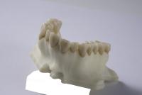 China Presicion Fit Implant Supported Dentures Implant Bar With Locator Attachments for sale