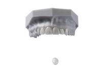 China Impact Resistant Dental Laminates And Veneers CAD CAM Veneers High Esthetic for sale