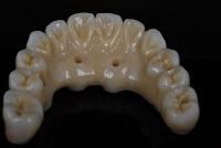 China Dental Implant Crown And Bridge High Esthetics Porcelain Crown Natural Looking for sale
