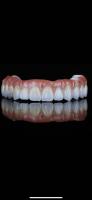 China Dental Implant Crown And Bridge High Esthetics Porcelain Crown Natural Looking for sale