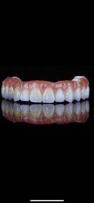 China Dental Implant Crown And Bridge High Esthetics Porcelain Crown Natural Looking for sale