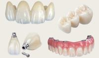 China Dental Exocad Skeletal Partial Framework Precision CAD CAM Partial Denture Solutions for sale