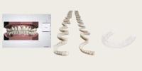 China Screw Retained Implant Crowns And Bridges High Esthetic Dental Restorations for sale