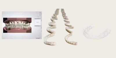 China Screw Retained Implant Crowns And Bridges High Esthetic Dental Restorations for sale