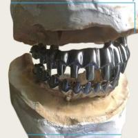 China Full Range Dental Lab Service Multi Layered Monolithic Zirconia Crowns for sale