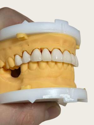 China Layered Zirconia Dental Crowns With Porcelain Fused To Metal High Esthetic For Clinics for sale