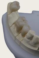 China Dental Lab Full Contour Zirconia Crowns High Translucency Solid Zirconia Crowns for sale