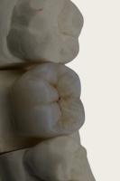 China Dental Lab Full Contour Zirconia Crowns High Translucency Solid Zirconia Crowns for sale