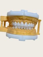 China Zirconia Dental Crown And Bridge With Layered Porcelain Precise Fit Wear Resistant for sale