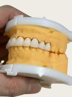 China Layered Zirconia Dental Crowns With Porcelain Fused To Metal High Esthetic For Clinics for sale