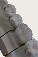 China Dental Lab Full Contour Zirconia Crowns High Translucency Solid Zirconia Crowns for sale