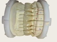 China Precise Dental Lab Crowns High Esthetic Porcelain Zirconia Tooth Crowns Natural Looking for sale