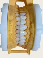 China Zirconia Dental Crown And Bridge With Layered Porcelain Precise Fit Wear Resistant for sale