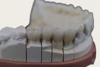 China Precise Dental Lab Crowns High Esthetic Porcelain Zirconia Tooth Crowns Natural Looking for sale