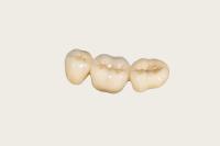 China High Accurate Dental Lab Zirconia Crowns And Bridge FDA Compliant Teeth Crowns for sale