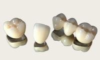 China Multilayered Zirconia Dental Crown And Bridge High Translucency CAD CAM Design for sale