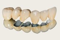 China Full Contour Dental Crown And Bridge Precision Teeth Zirconia Crowns CE FDA Certified for sale