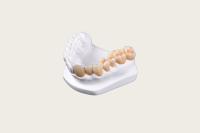 China Accurate Dental Lab Crowns Dental Zirconia Crown High Strength Strong Biocompatibility for sale