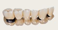 China Full Contour Dental Crown And Bridge Precision Teeth Zirconia Crowns CE FDA Certified for sale