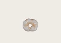China Natural Looking Biocompatible Dental Implant Crown Bridge For Dental Restoration for sale