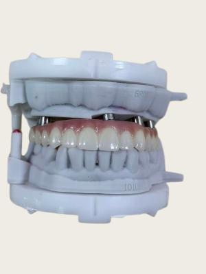 China High Accuracy Dental Implant Crown And Bridge For Natural Tooth Contour Enhancing for sale
