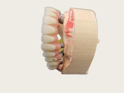 China Dental Implant Metal Ceramic Bridges Titanium Abutments CAD CAM High Precision for sale
