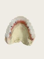 China Dental Implant Metal Ceramic Bridges Titanium Abutments CAD CAM High Precision for sale