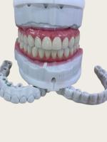 China High Accuracy Dental Implant Crown And Bridge For Natural Tooth Contour Enhancing for sale