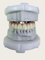 China High Accuracy Dental Implant Crown And Bridge For Natural Tooth Contour Enhancing for sale