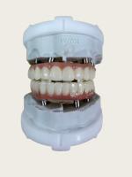 China High Accuracy Dental Implant Crown And Bridge For Natural Tooth Contour Enhancing for sale