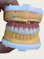 China Customized Dental Implant Crown Bridge Tibase Zirconia Abutments Accurate Fit for sale