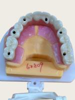 China Customized Dental Implant Crown Bridge Tibase Zirconia Abutments Accurate Fit for sale