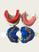 China Zirconia Dental Implant Crowns Titanium CAD CAM Abutments For Tooth Restoration for sale