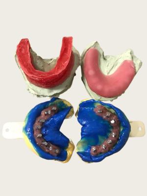 China Zirconia Dental Implant Crowns Titanium CAD CAM Abutments For Tooth Restoration for sale