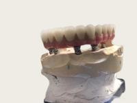 China Full Zirconia Bridge With Titanium Bar Support Full Arch Solutions Comfortable Fit for sale