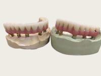 China Full Zirconia Bridge With Titanium Bar Support Full Arch Solutions Comfortable Fit for sale