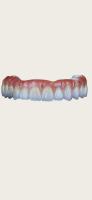 China High Accuracy Esthetic Full Zirconia Bridge With Titanium Bar Screwed Retained for sale