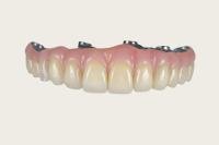 China High Accuracy Esthetic Full Zirconia Bridge With Titanium Bar Screwed Retained for sale