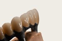 China Dental Zirconia Bridge Over Titanium Bar High Precision Implant Restorations for sale