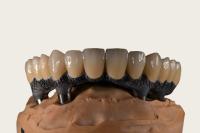 China Dental Zirconia Bridge Over Titanium Bar High Precision Implant Restorations for sale