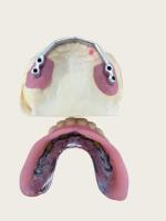 China Dental Removable Precision Attachment Partial Denture High Strength Customizable for sale