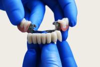China High Accuracy Dental Lab Telescopic Crowns Natural Looking Custom Shape for sale