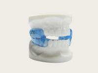 China Acrylic Hawley Retainer CAD CAM Orthodontic Appliance For Dental Alignment for sale