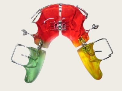 China Adjustable Comfortable Teeth Palate Expander CAD CAM Orthodontic Dental Appliance for sale