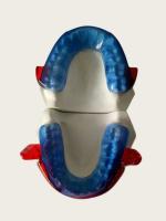 China Full Anatomy Screw Retained Implant Bridge Full Arch Dental Implant Bridge for sale